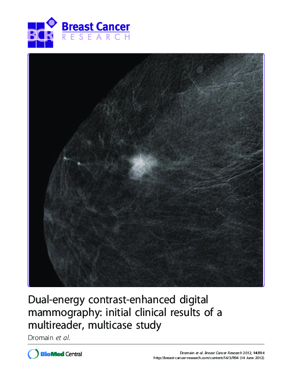 (PDF) Dual-energy contrast-enhanced digital mammography: initial ...