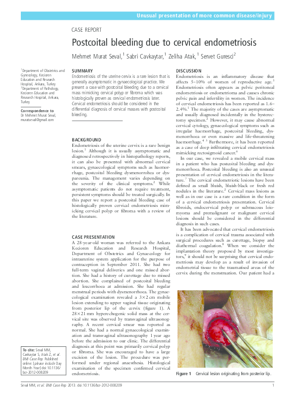 (PDF) Postcoital bleeding due to cervical endometriosis