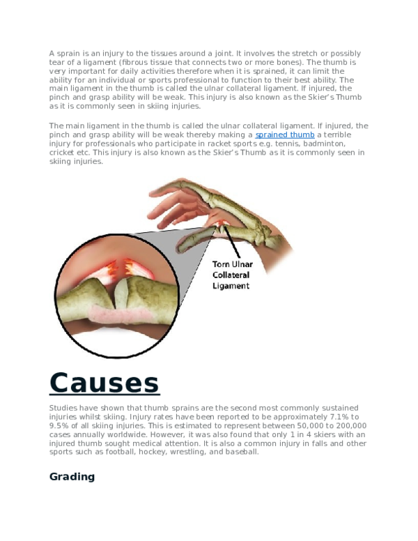 (DOC) Sprained Thumb