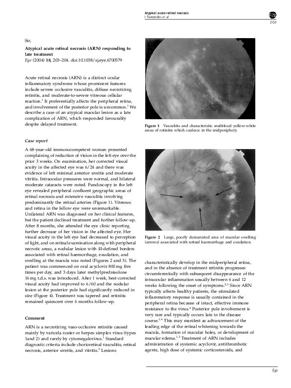 Pdf Atypical Acute Retinal Necrosis Arn Responding To Late