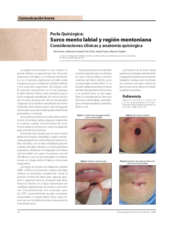 (PDF) Perla Quirúrgica: Surco mento labial y región mentoniana ...