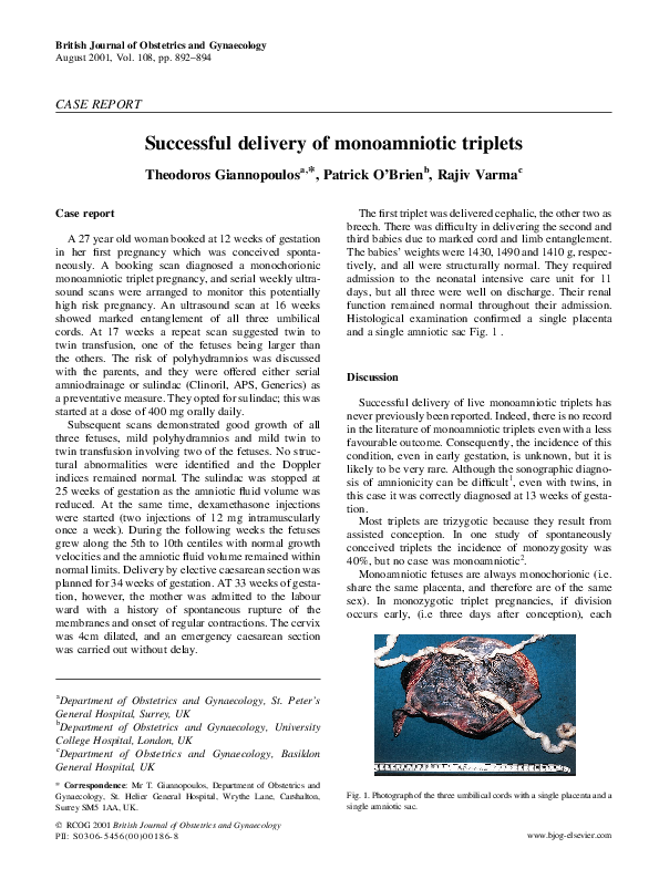 (PDF) Successful delivery of monoamniotic triplets