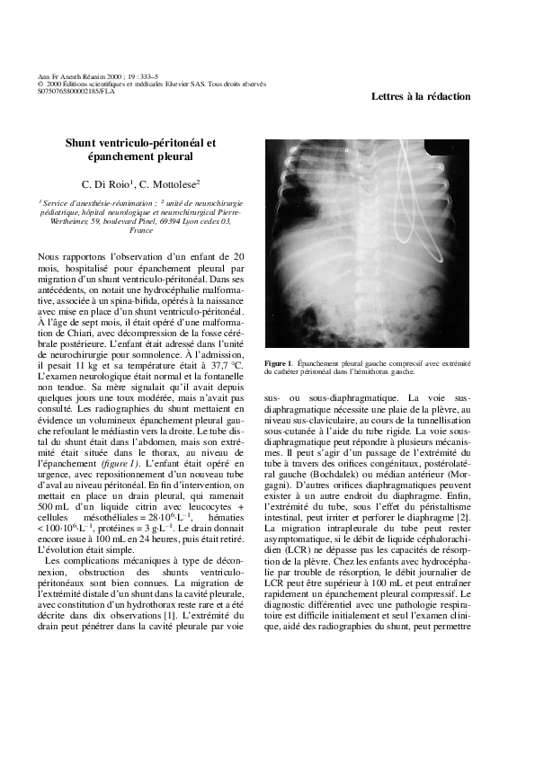 (PDF) Shunt ventriculo-péritonéal et épanchement pleural | Carmine ...