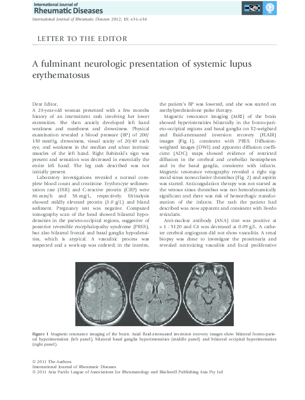 (PDF) A fulminant neurologic presentation of systemic lupus erythematosus