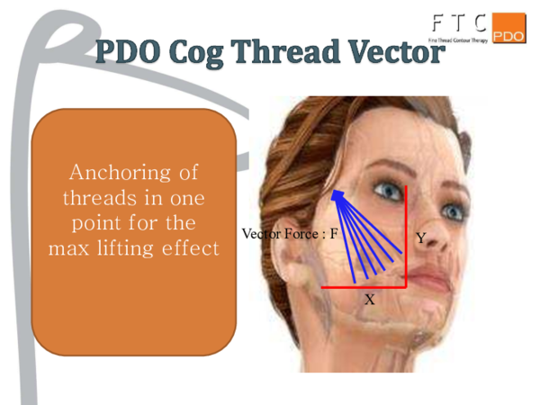 (PDF) Anchoring of threads in one point for the max lifting effect X Y ...
