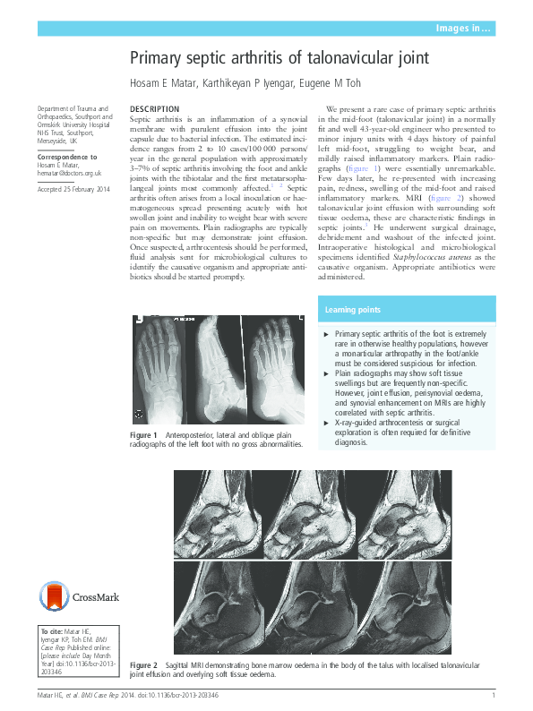 (PDF) Primary septic arthritis of talonavicular joint
