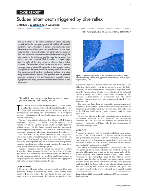 (PDF) Sudden infant death triggered by dive reflex