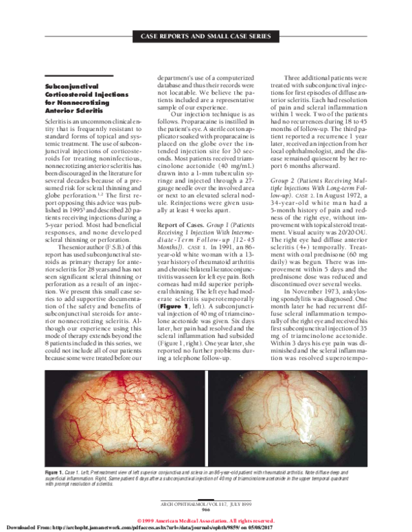 (PDF) Subconjunctival Corticosteroid Injections for Nonnecrotizing ...