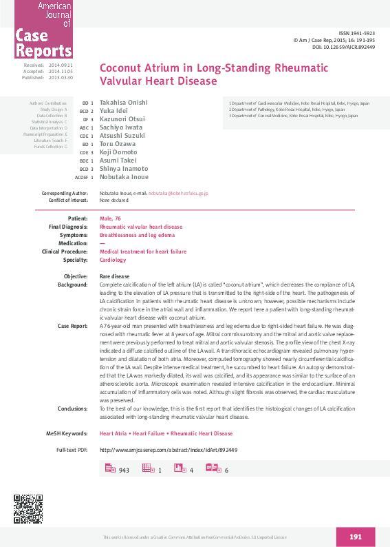 Coconut Atrium in Long-Standing Rheumatic Valvular Heart Disease