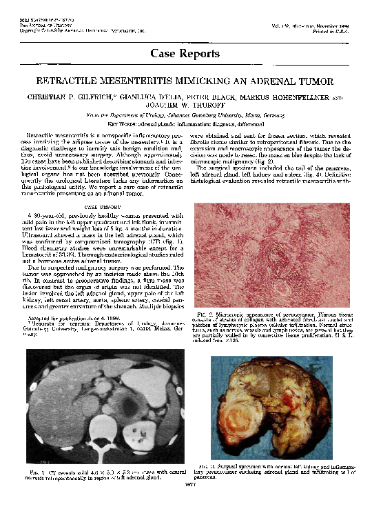 (PDF) Retractile Mesenteritis Mimicking an Adrenal Tumor