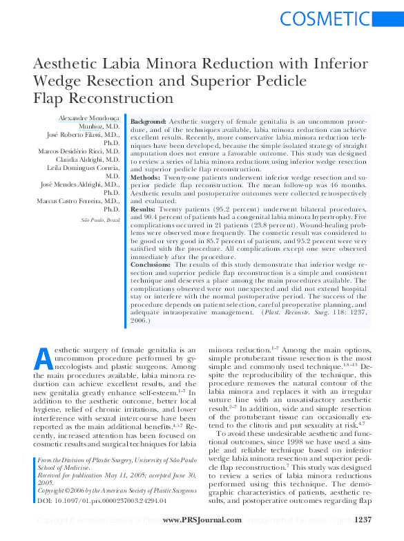 (PDF) Aesthetic Labia Minora Reduction with Inferior Wedge Resection ...