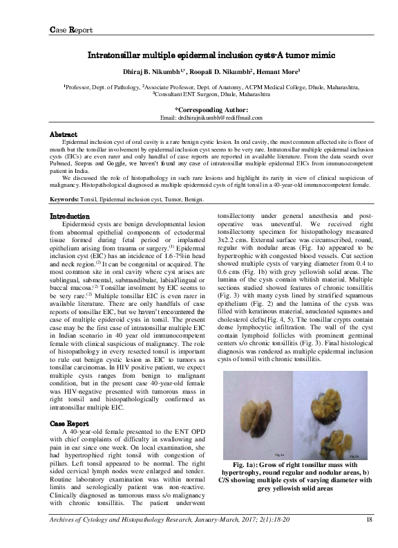 (PDF) Intratonsillar multiple epidermal inclusion cysts-A tumor mimic