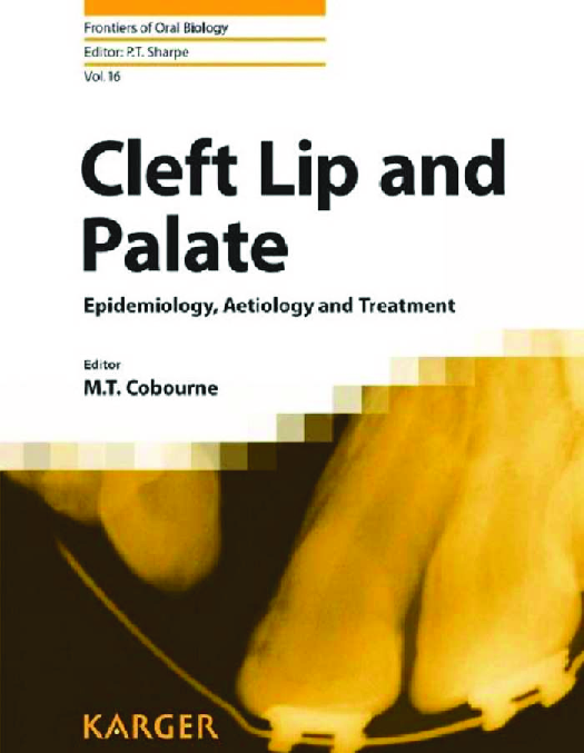 (PDF) Cleft Lip and Palate