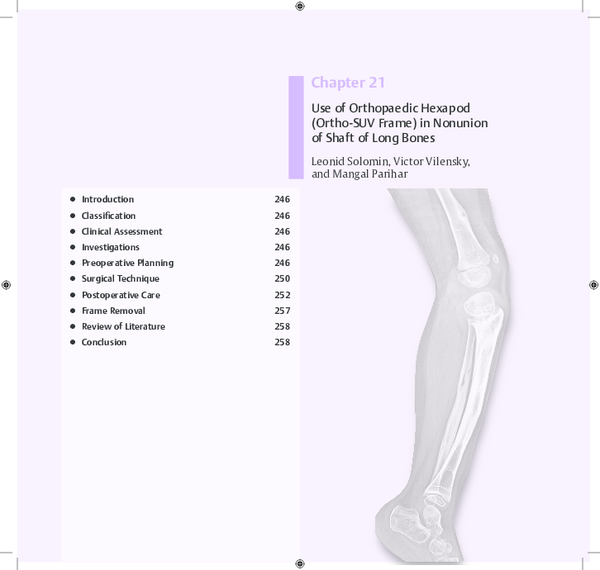 (PDF) Use of Orthopaedic Hexapod (Ortho-SUV Frame) in Nonunion of Shaft ...