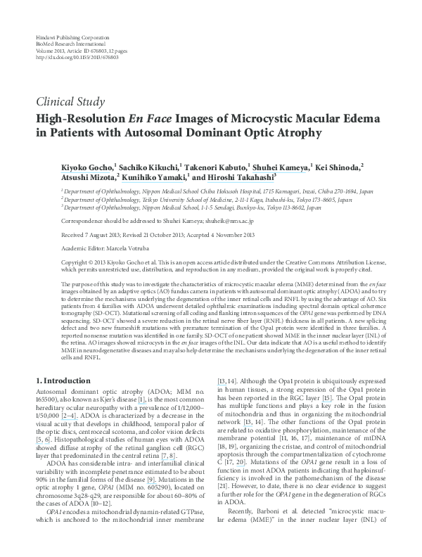 (PDF) High-resolution en face images of microcystic macular edema in ...