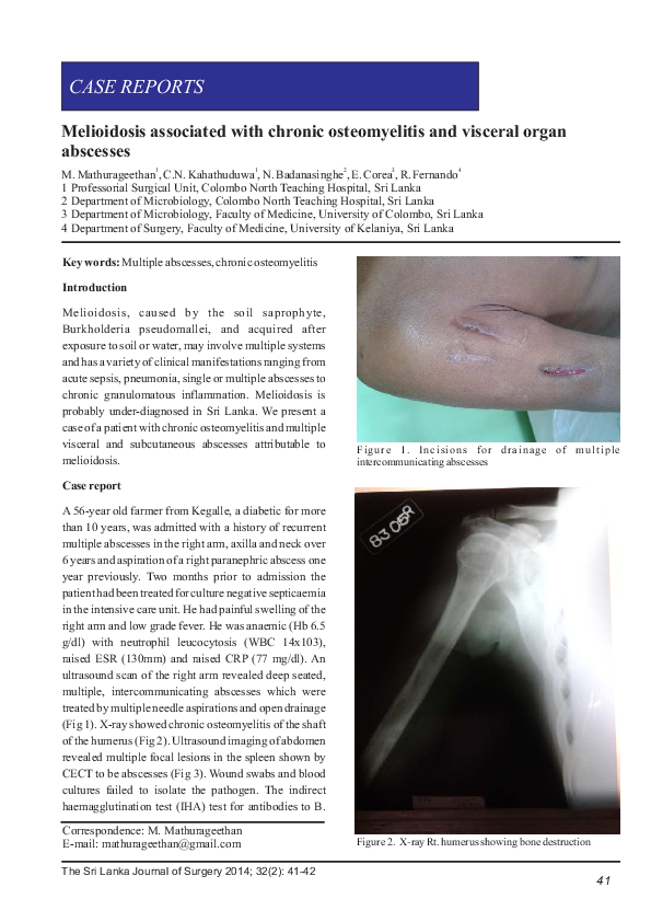 (PDF) Melioidosis associated with chronic osteomyelitis and visceral ...