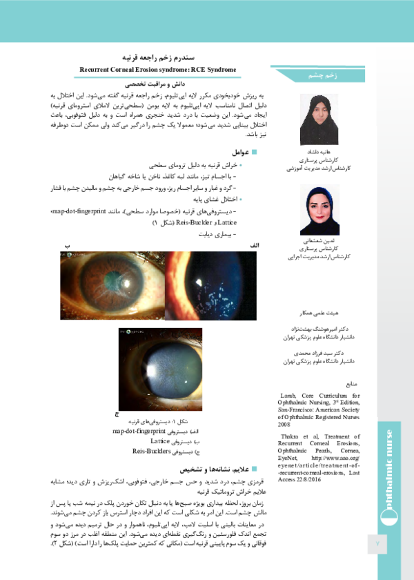 (PDF) Recurrent Corneal Erosion syndrome: RCE Syndrome, سندرم زخم راجعه ...