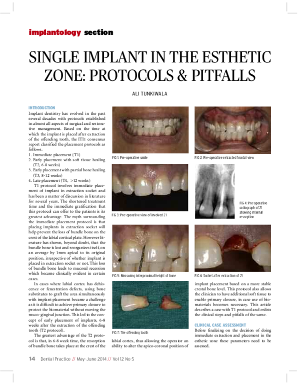 (PDF) Single Implants in the Esthetic Zone