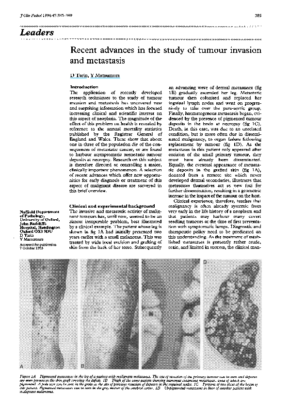 (PDF) Recent advances in the study of tumour invasion and metastasis