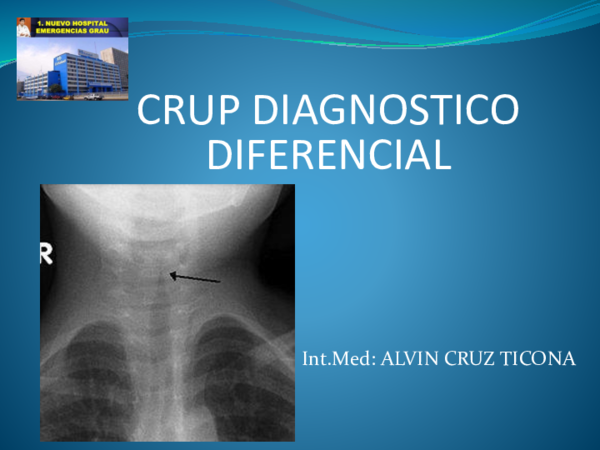 Radiografía De Crup NUEVOS CONCEPTOS DE LA LARINGOTRAQUEÍTIS EN