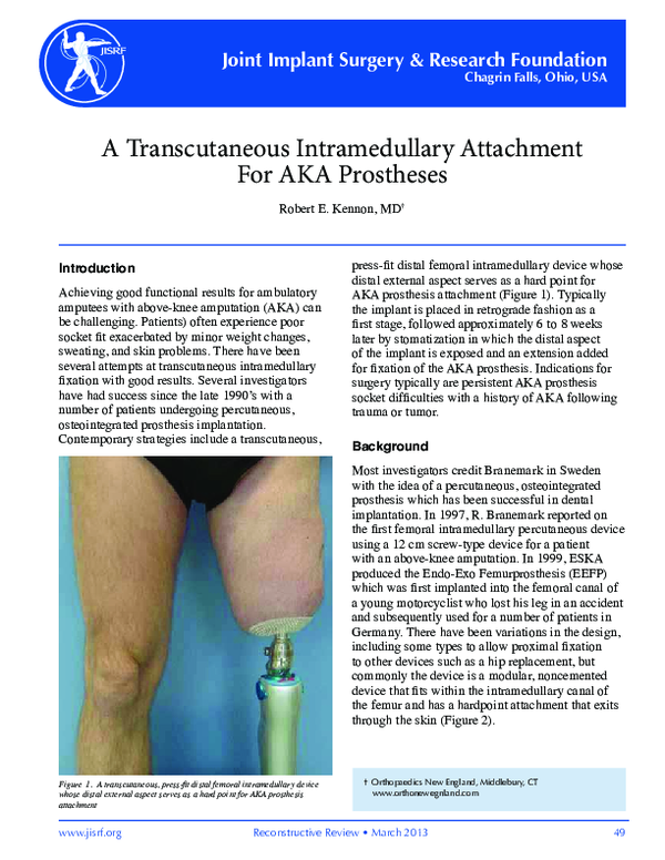 (PDF) A Transcutaneous Intramedullary Attachment For AKA Prostheses