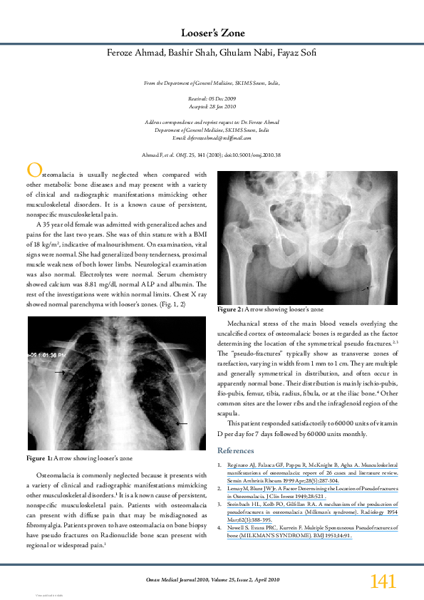 (PDF) Looser’s Zone