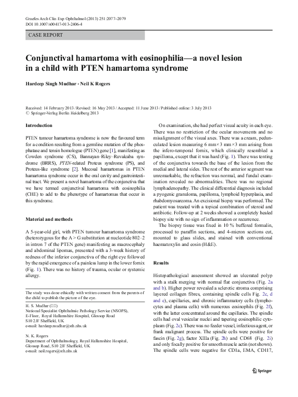 (PDF) Conjunctival hamartoma with eosinophilia—a novel lesion in a ...