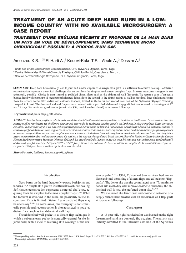 (PDF) Treatment of acute deep hand burn