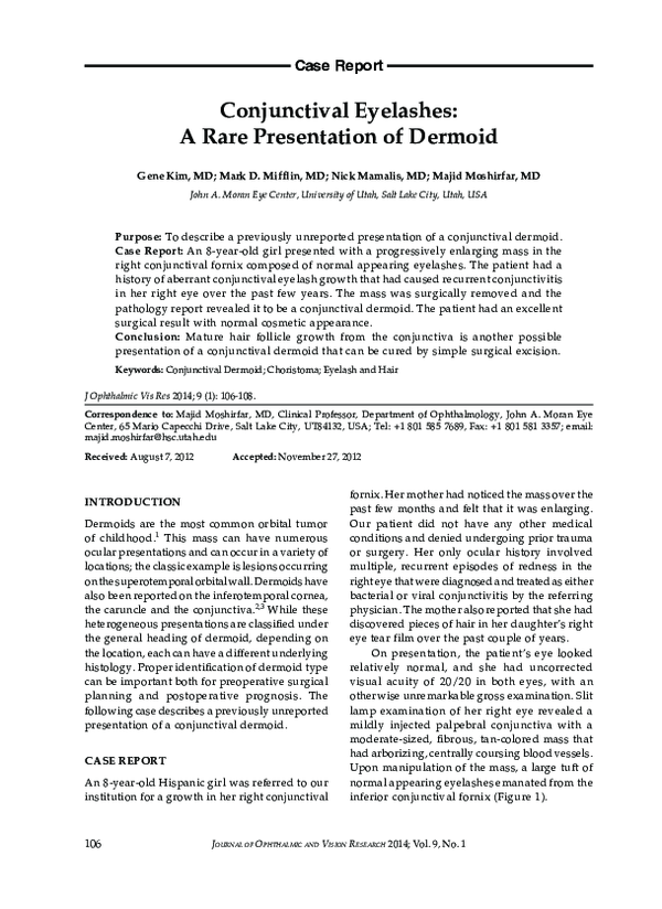 (PDF) Conjunctival eyelashes: a rare presentation of dermoid
