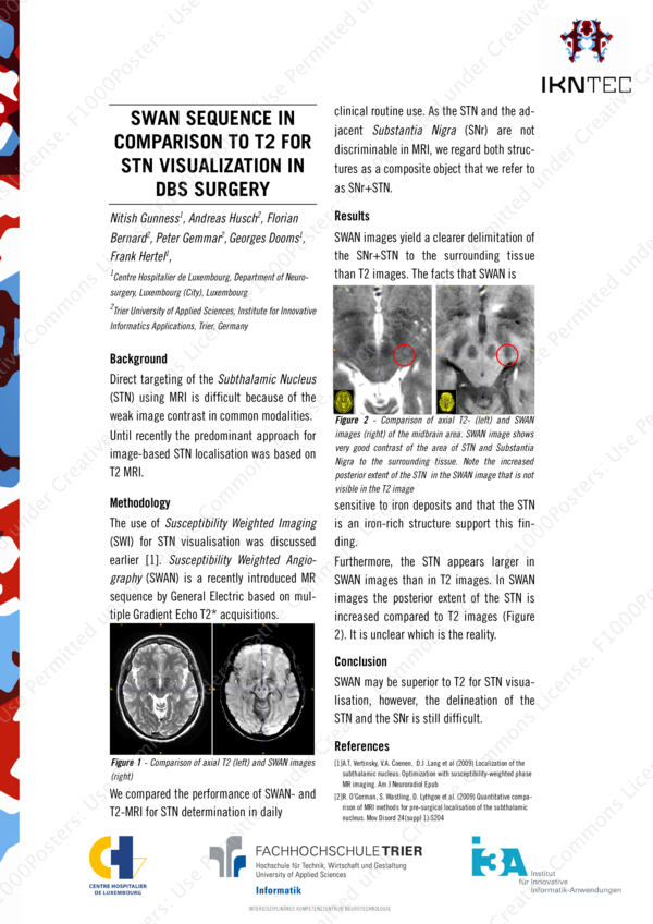 (PDF) SWAN sequence in comparison to T2 for STN visualisation in DBS ...