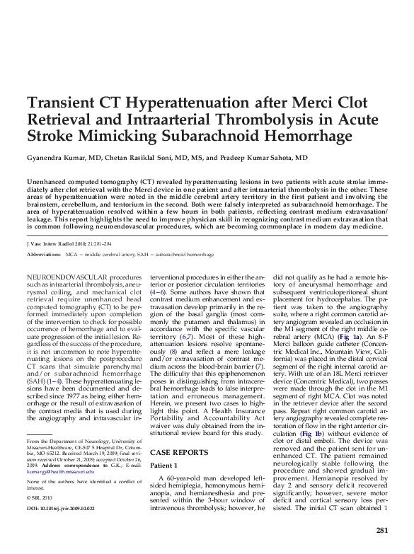 (PDF) Transient CT Hyperattenuation after Merci Clot Retrieval and Intraarterial Thrombolysis in ...