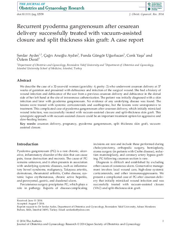 (PDF) Recurrent pyoderma gangrenosum after cesarean delivery successfully treated with vacuum ...