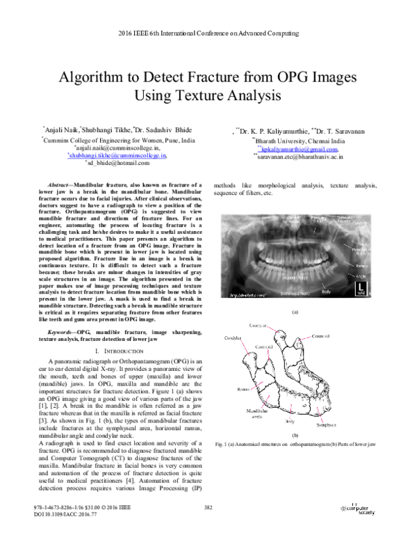 (PDF) Algorithm to Detect Fracture from OPG Images Using Texture Analysis