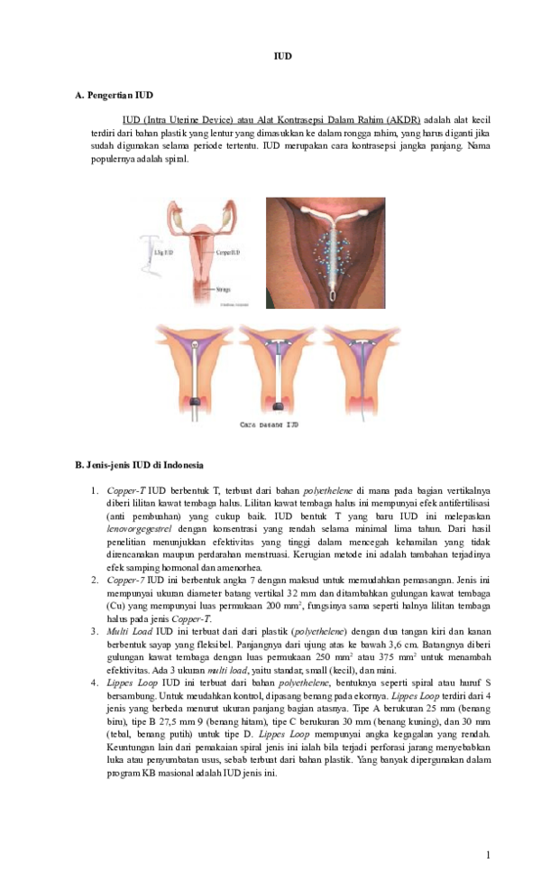 (DOC) materi iud.doc