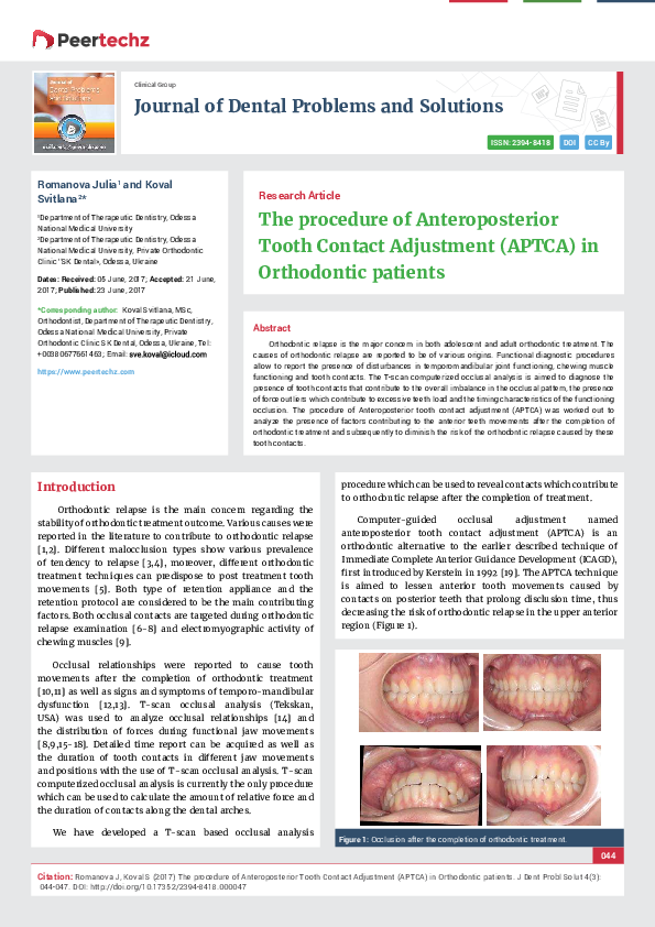 (PDF) The procedure of Anteroposterior Tooth Contact Adjustment (APTCA ...
