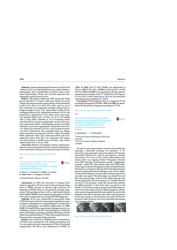 (PDF) The University of Glasgow ECG Analysis Algorithm is Not Specific ...