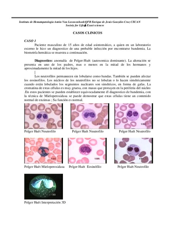 (PDF) Casos hematologia