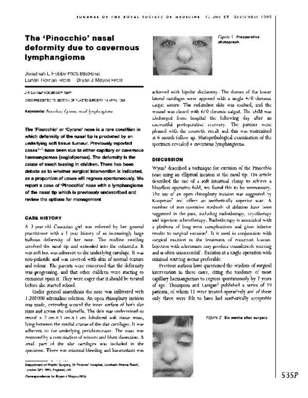 (PDF) The 'Pinocchio' nasal deformity due to cavernous lymphangioma ...