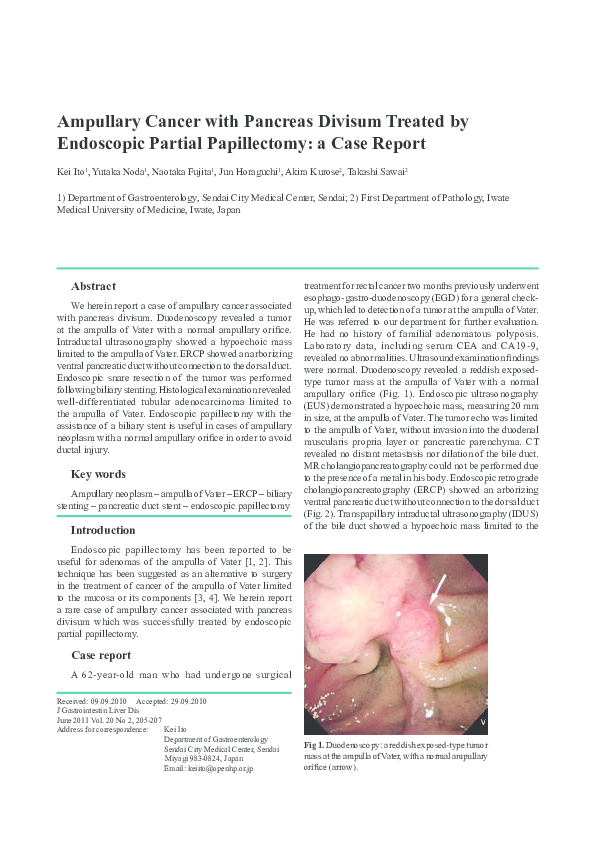 (PDF) Ampullary cancer with pancreas divisum treated by endoscopic ...