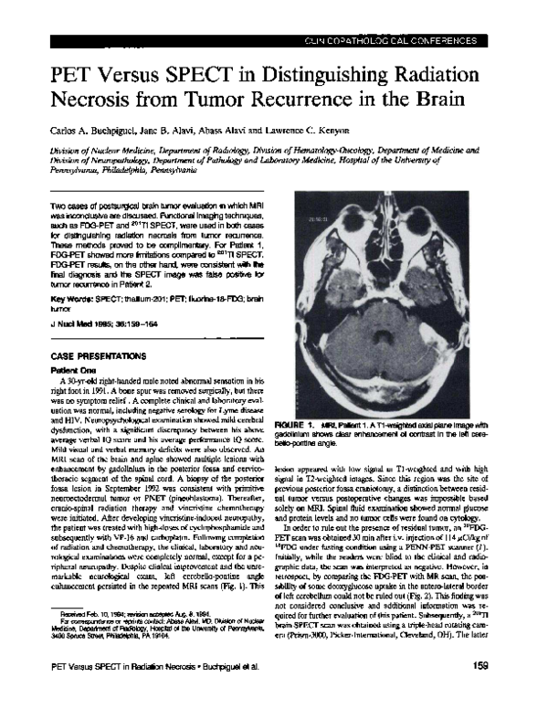 (PDF) PET versus SPECT in distinguishing radiation necrosis from tumor ...