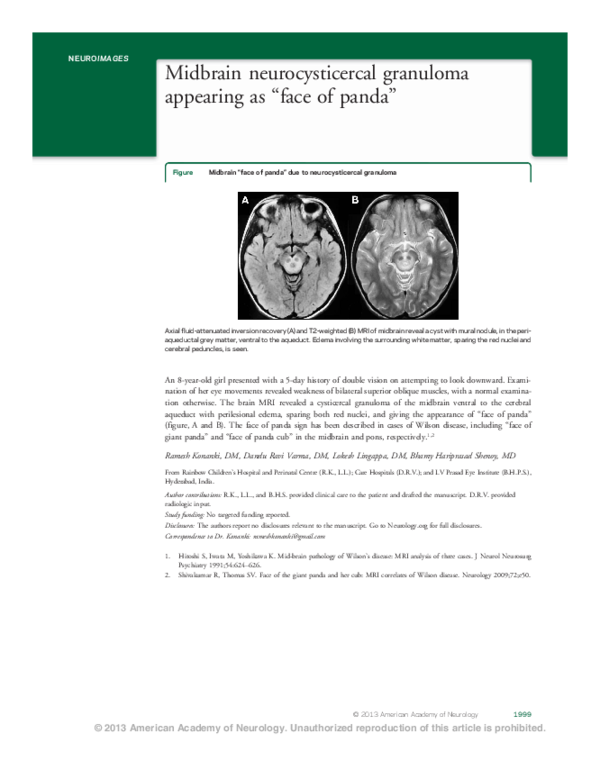 (PDF) Midbrain neurocysticercal granuloma appearing as "face of panda