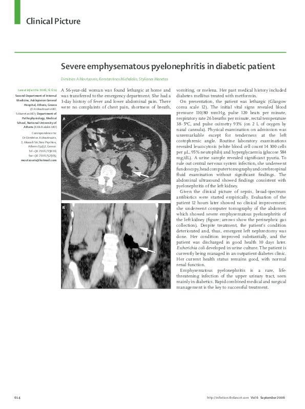 (PDF) Severe emphysematous pyelonephritis in diabetic patient