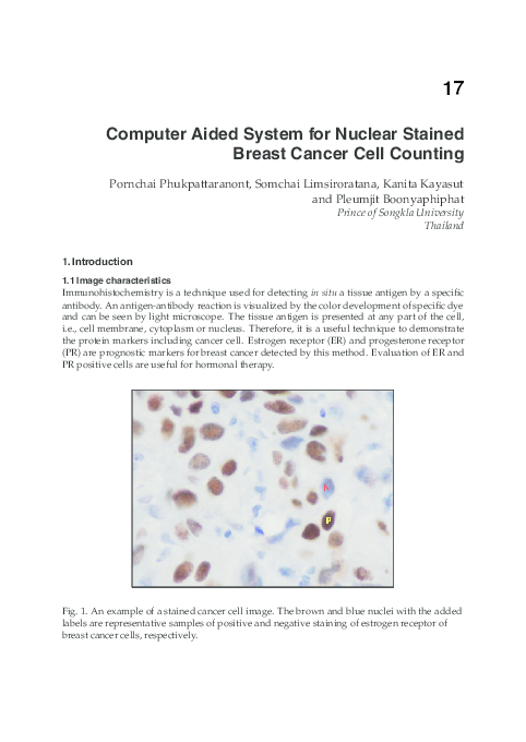 (PDF) Computer Aided System for Nuclear Stained Breast Cancer Cell Counting