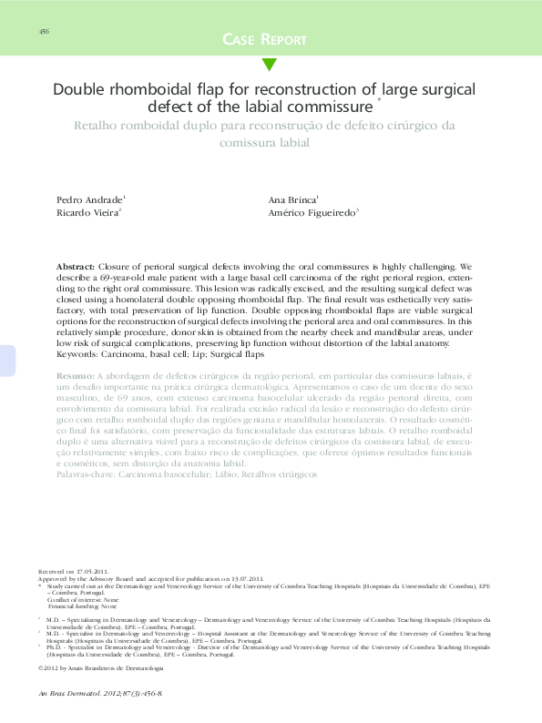 (PDF) Double rhomboidal flap for reconstruction of large surgical ...