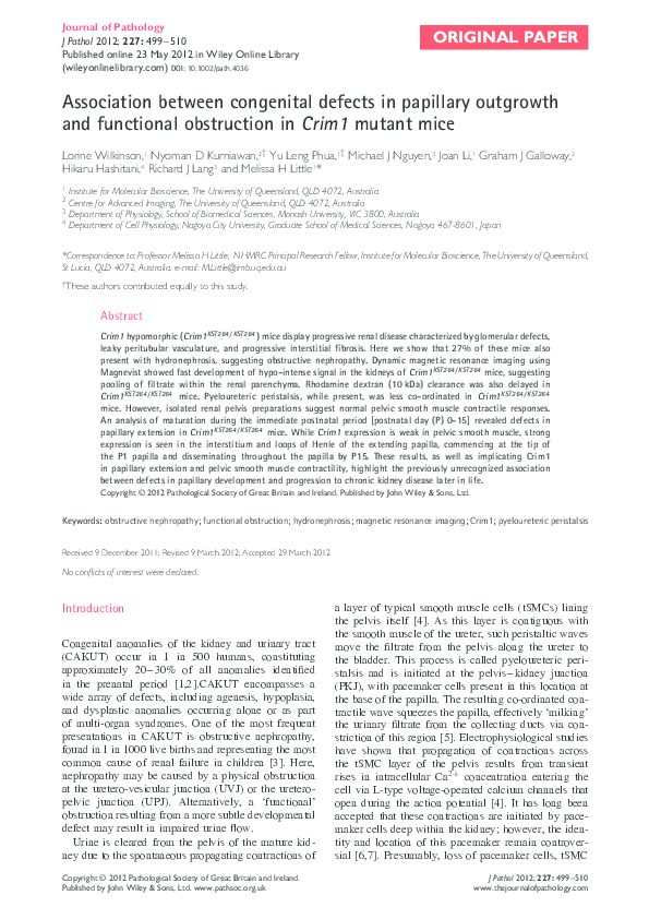 (PDF) Association between congenital defects in papillary outgrowth and ...