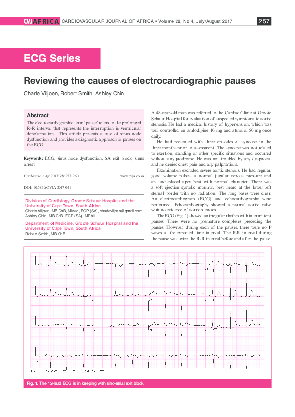(PDF) Reviewing the causes of electrocardiographic pauses