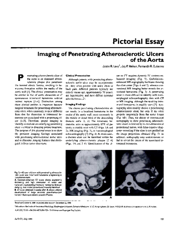 (PDF) Penetrating atherosclerotic ulcers of the aorta