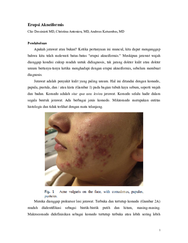 (DOC) Erupsi Akneiformis