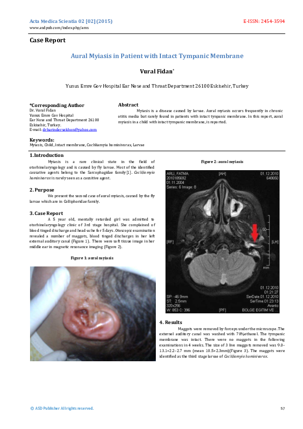 (PDF) Aural Myiasis in Patient with Intact Tympanic Membrane