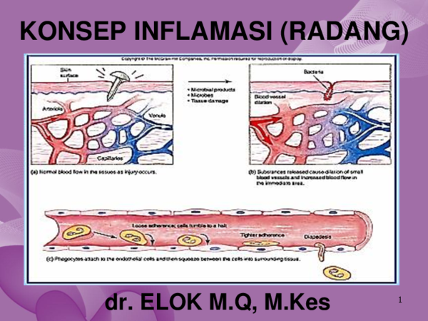 (PPT) 13Konsep Inflamasi.pptx